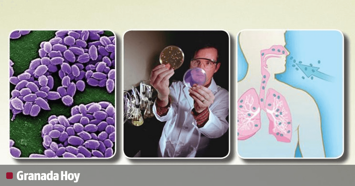 Video: ¿Qué es el ántrax? Conoce los detalles sobre esta enfermedad ...